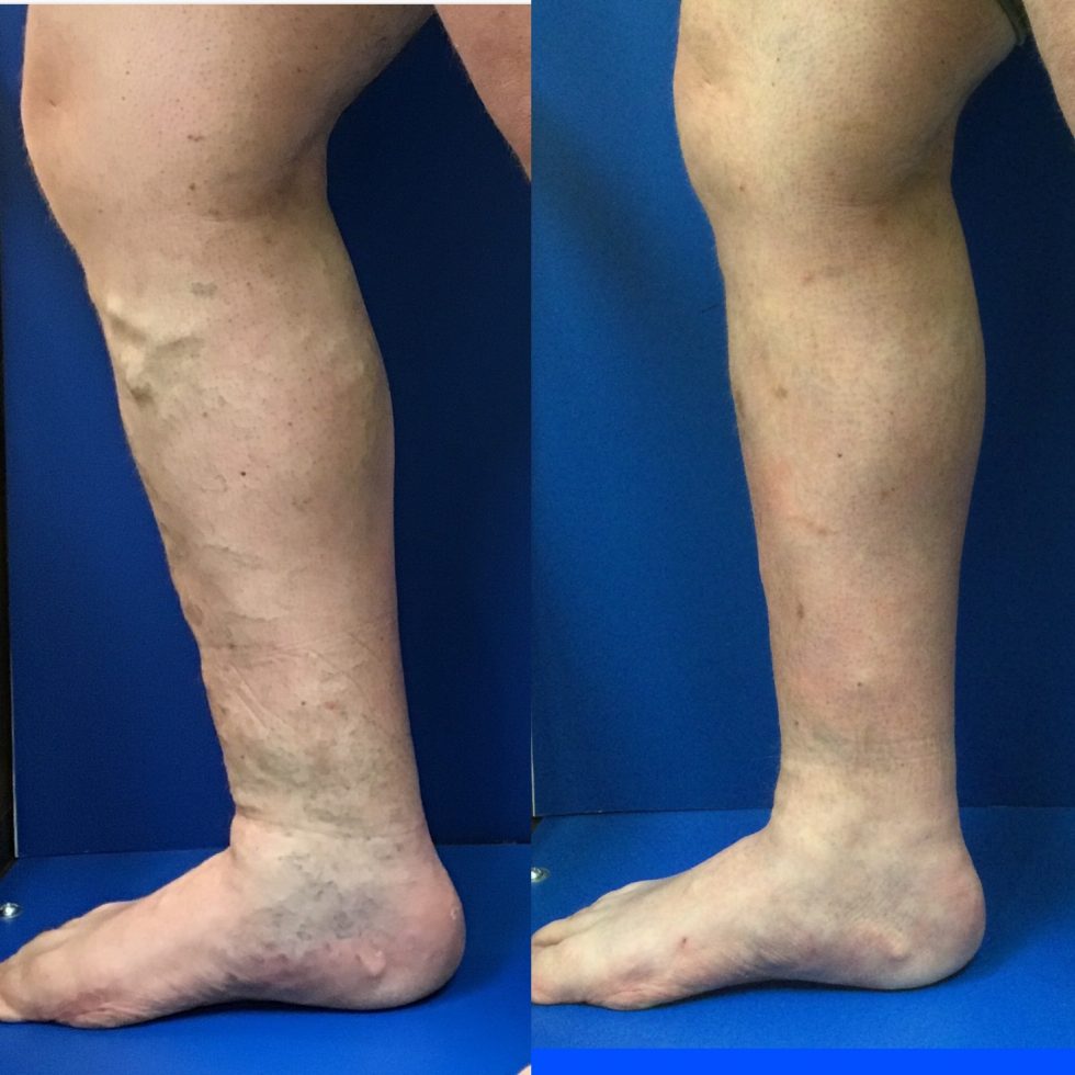 Transformation Tuesday Goes Beyond The Before And Aft