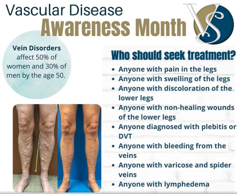 September is Vascular Disease Awareness Month - Vein Specialists of the ...