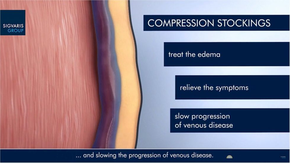 It's Time To Give Your Legs The Attention They Deserve. - Vein ...