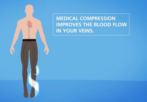Medical Compression Therapy - Minimize the Risks - Vein Specialists of ...