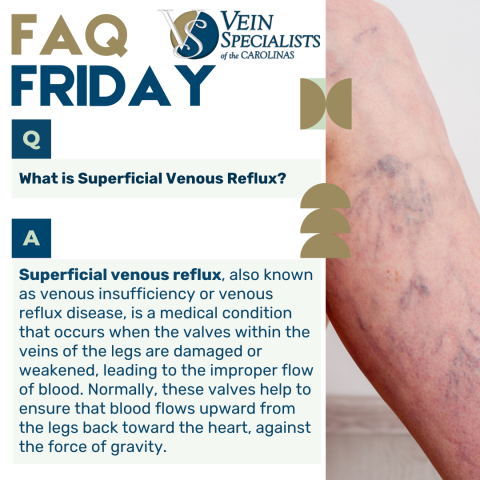 FAQ Friday: What is Superficial Venous Reflux? - Vein Specialists of ...