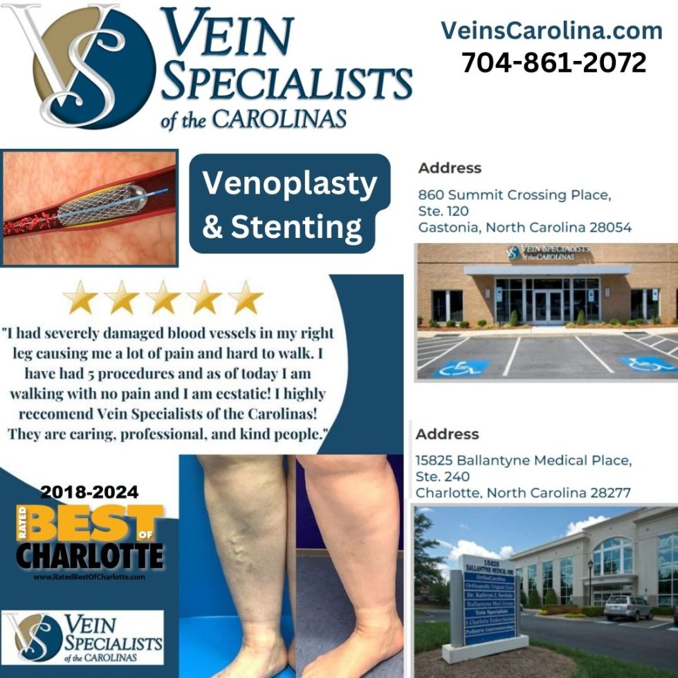 Venoplasty and Stenting - Groundbreaking Procedure for Vein Conditions ...