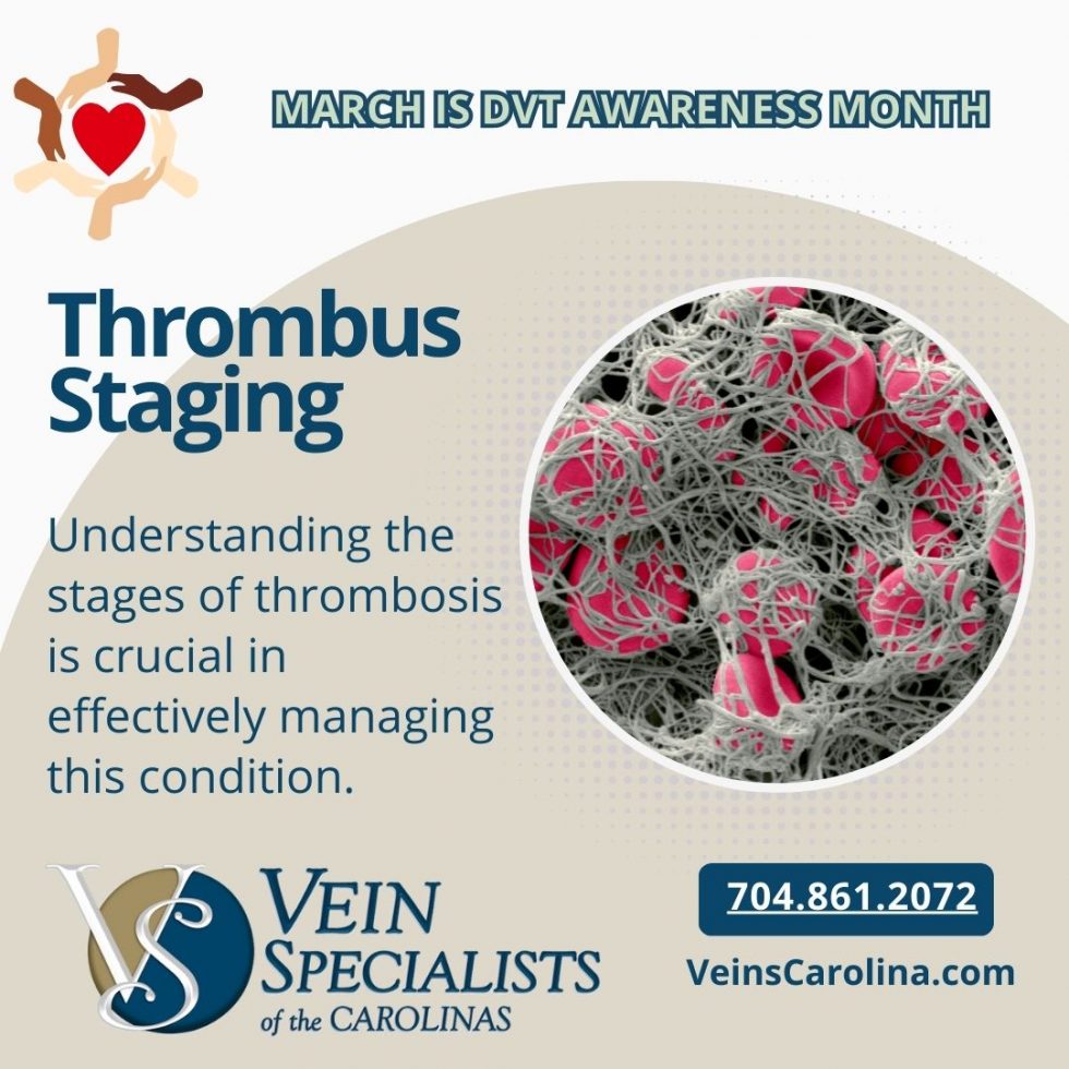 Deep Vein Thrombosis (DVT) - Vein Specialist of the Carolinas